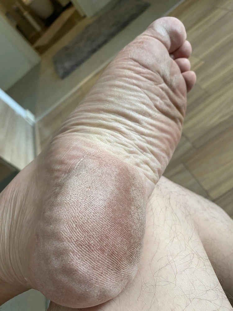 My Close Up Feet And Soles 21 Pics Xhamster