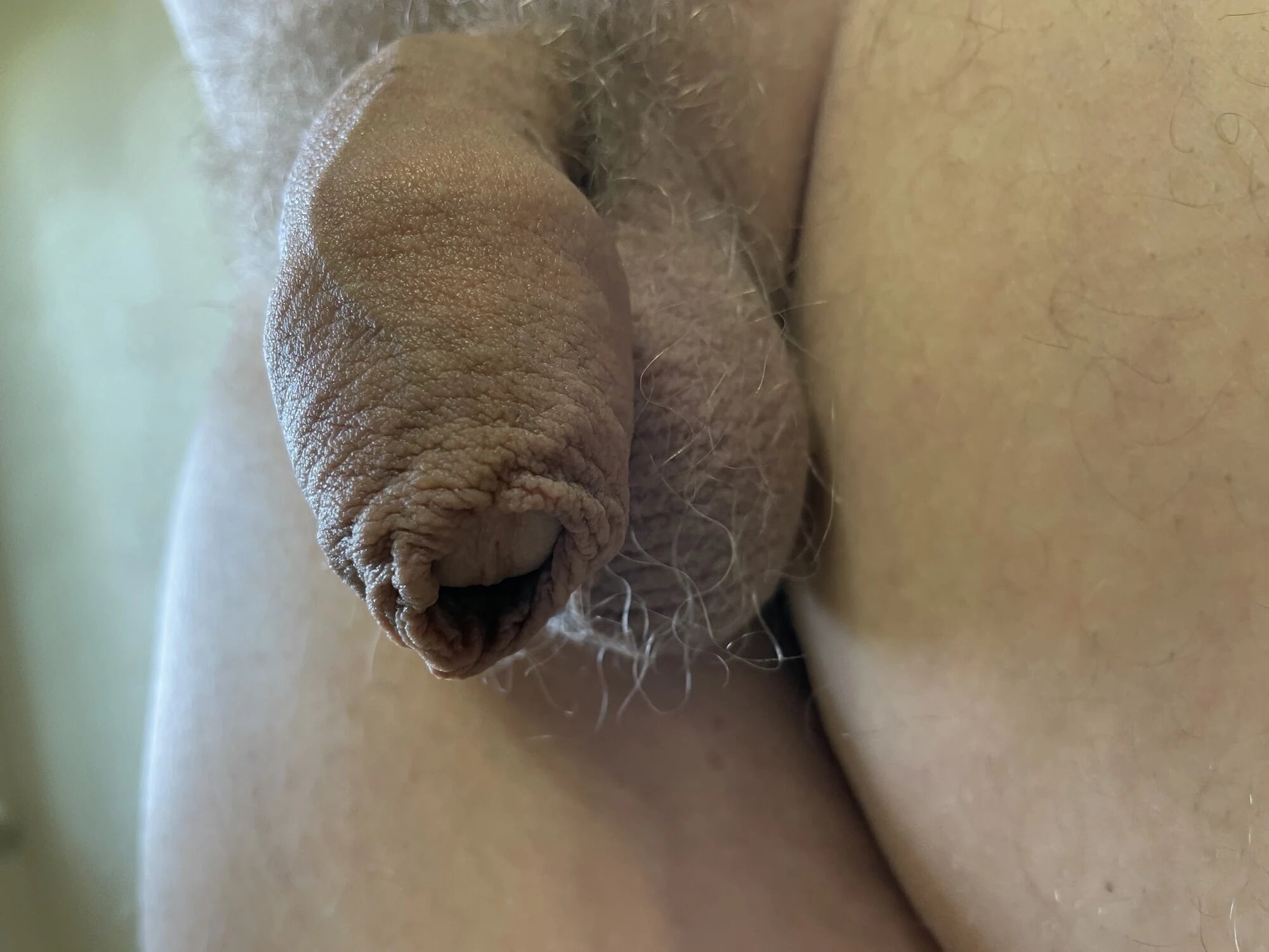 Uncut Penis Soft 1 Pics Xhamster 8865