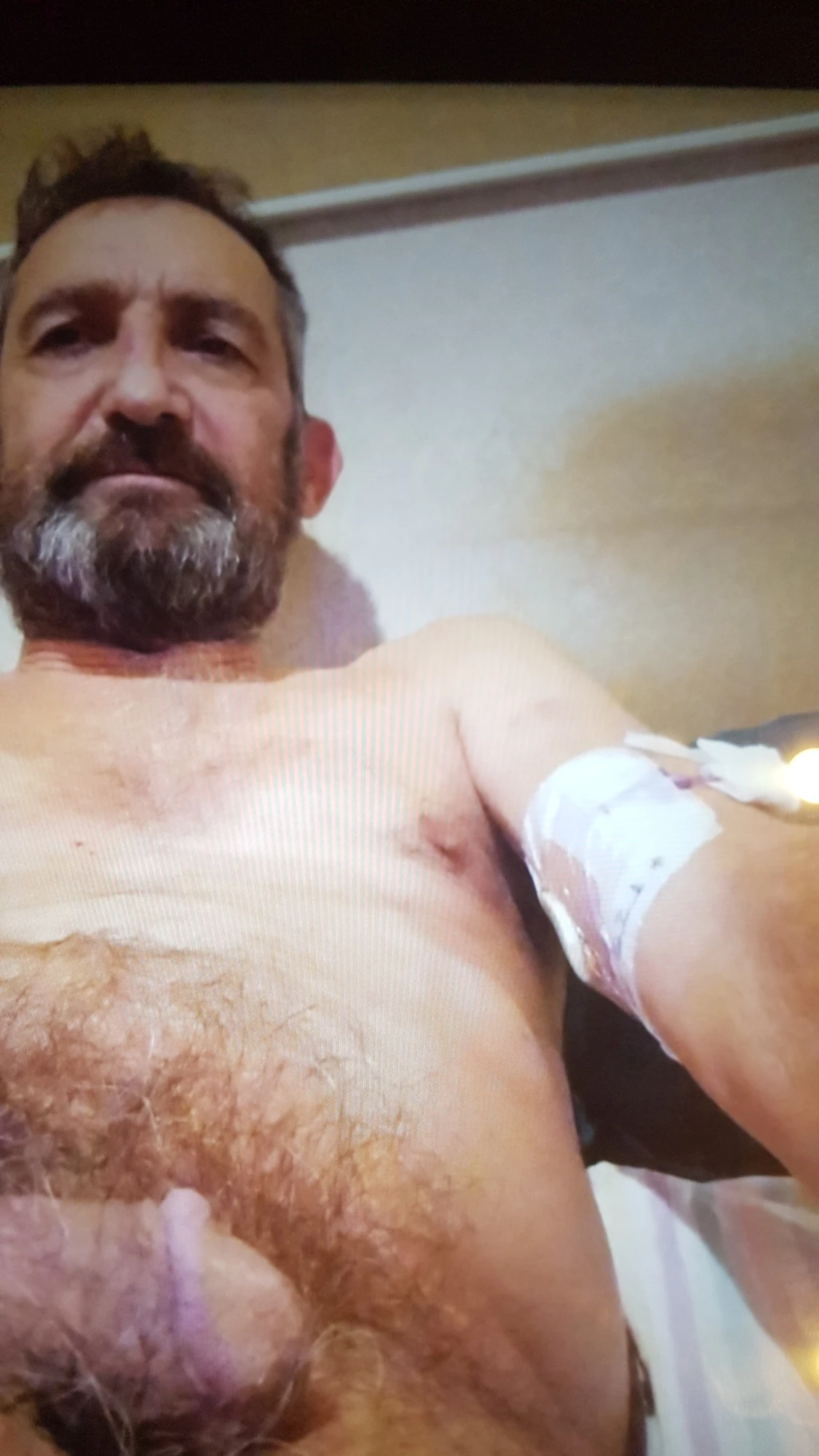 Steve Cancer Pictures 3 Pics Xhamster