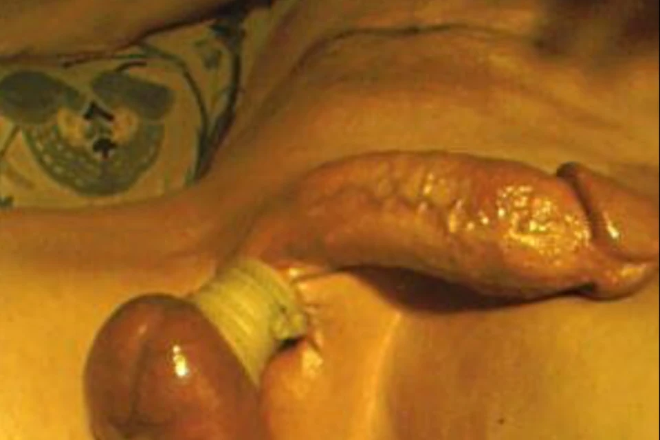 Scrotum Stretching 10 Pics Xhamster